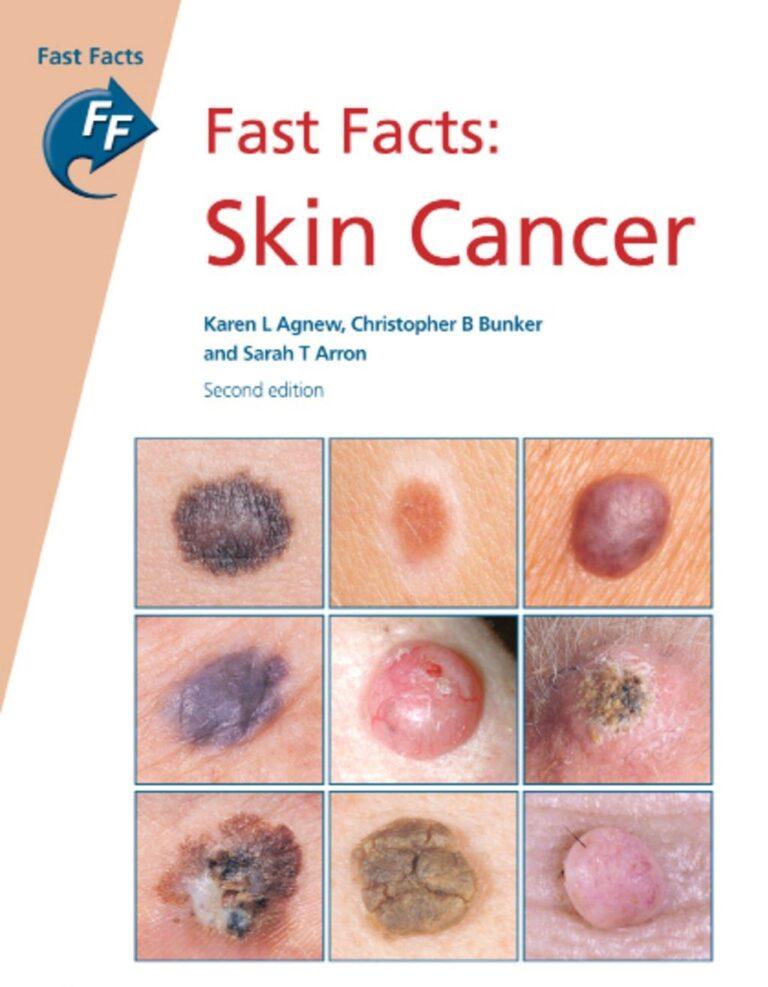 Revealing the Truth about Skin Cancer: Causes, Risk Factors and Symptoms