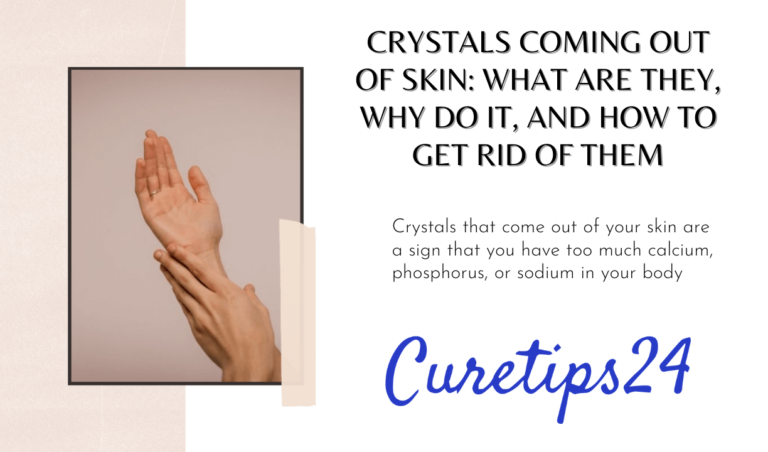 Crystals Coming Out of Skin: What are they, why do it, and how to get ...