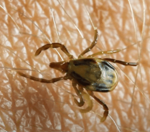 What to Do If You Find Tick in Your Hair: Removal & Prevention